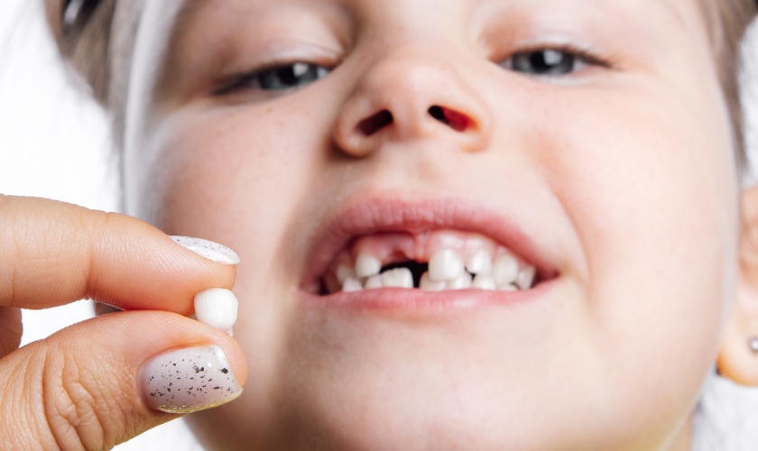 Once a Baby Tooth Breaks, How Long Does It Take to Come Up
